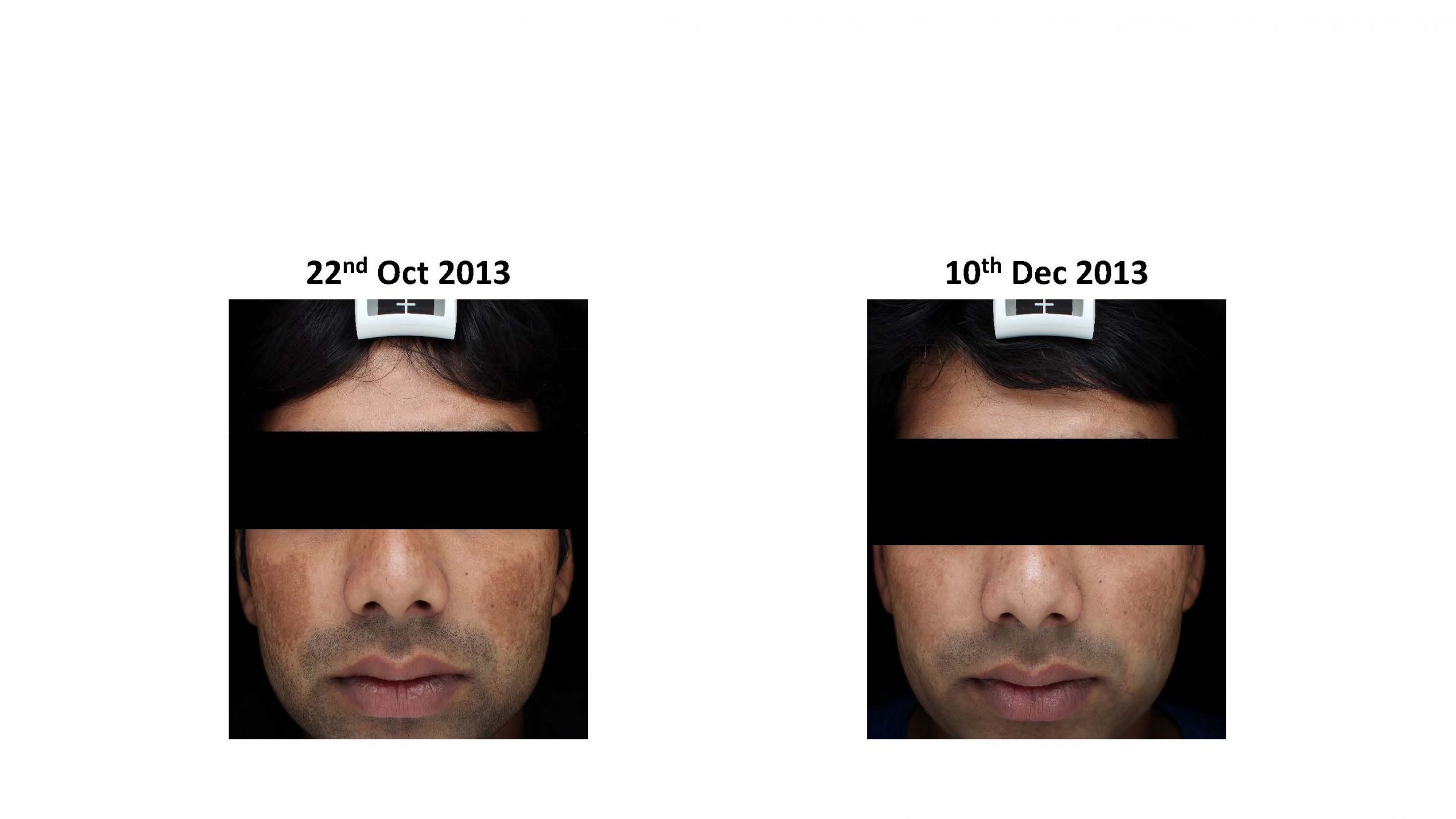 Home - Official website of Crystal Tomato®